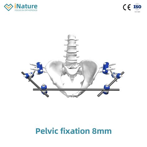 Pelvis And Hip External Fixator Pelvis Pricesupplier Inature