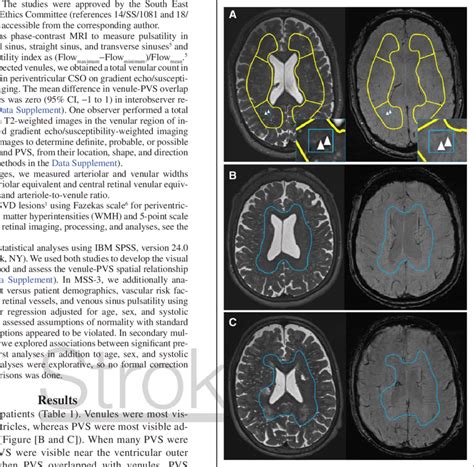 Figure Examples Of Venules Related To Perivascular Spaces Pvs A Download Scientific