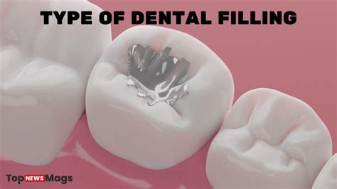 Hammad Mohsin On Linkedin What Type Of Dental Filling Is Better A Guide To Choosing The Right…