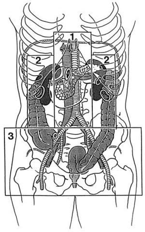 Retroperitoneal Hemorrhage Wikem