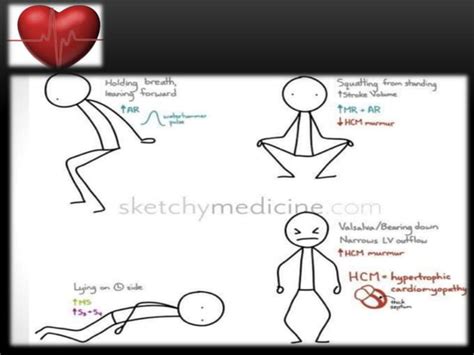 Heart Sounds And Murmurs PPT Heart Sounds And Murmurs PPT