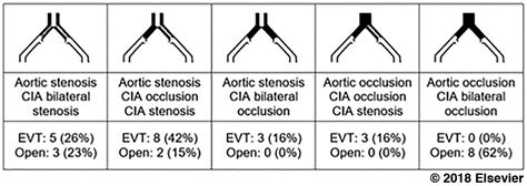 Trans Atlantic Inter Society Consensus Class D Aortoiliac Lesions A