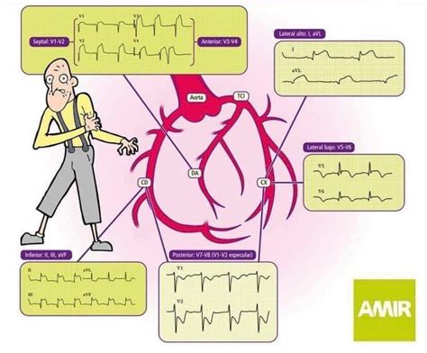 Best 13 Ecg Interpretation Cheat Sheet Pdf Electrocardiography Cardiac Electrophysiology
