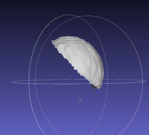 Best Fit Sphere on Point Cloud by Python Script医療のためのPythonプログラミング