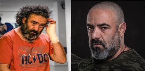 موبلندترین بازیگر صدا و سیما با سری کچل و طاس کدوم بیشتر بهش میاد