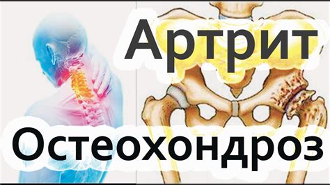 Избавьтесь от БОЛИ в спине ногах и СУСТАВАХ за 7 дней Youtube