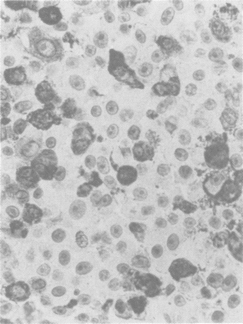 Immunohistochemical Detection Of Fcv In A Section Of Formalin Fixed