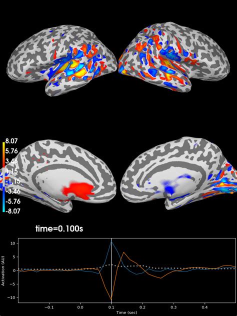 Decoding Mvpa — Mne 1 3 1 Documentation