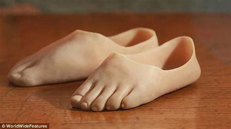 Saket Toe Silicon Prosthesis At ₹ 65000 In Nagpur Id 11024933862