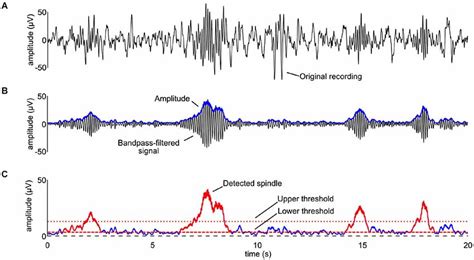 The Spindle Detection Procedure Described In Detail A The Original