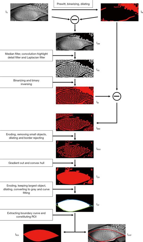 an automated and multiparametric algorithm for objective analysis of meibography images pmc
