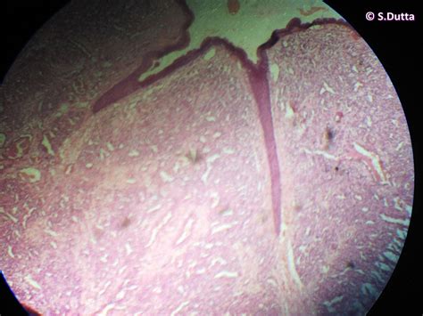 Cnmc Roll Histopathology Exam Slides