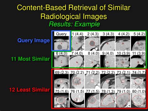 Ppt Content Based Retrieval Of Similar Radiological Images Powerpoint
