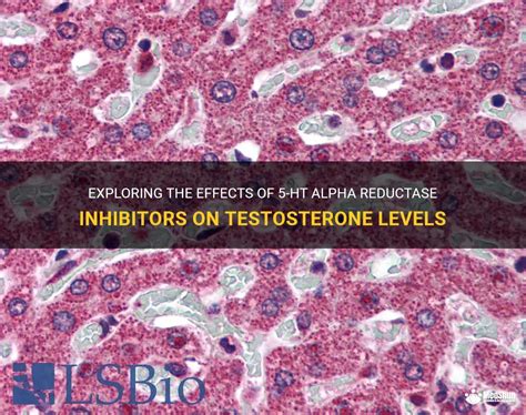 Exploring The Effects Of 5 Ht Alpha Reductase Inhibitors On Testosterone Levels Medshun