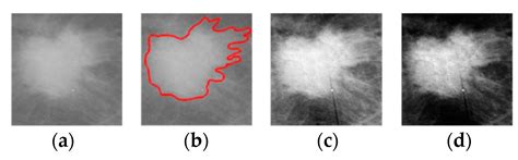 Applied Sciences Free Full Text A New Method For Detecting Architectural Distortion In