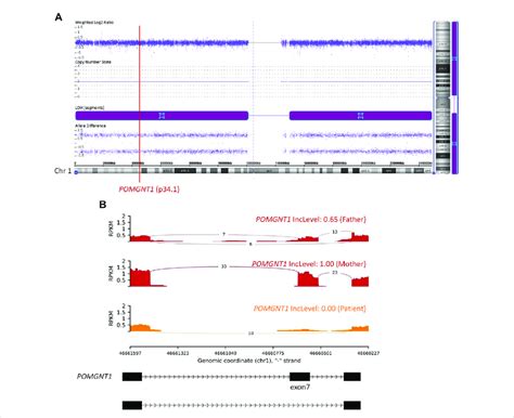 Chromosomal Microarray Analysis Labcorp At Marianne Pryor Blog