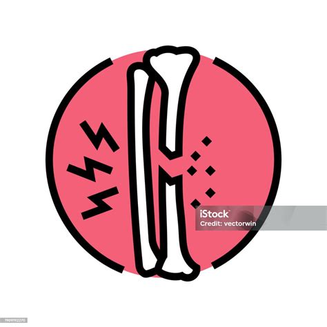 경골 골절 골다공증 뼈 색상 아이콘 벡터 일러스트 레이 션 건강관리와 의술에 대한 스톡 벡터 아트 및 기타 이미지 건강관리와 의술 골다공증 관절염 Istock