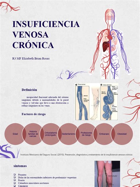 Guía De Insuficiencia Venosa Crónica Pdf Terapia Venas Varicosas