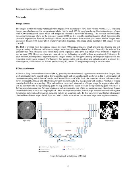 Treatment Classification Of Posterior Capsular Opacification Pco