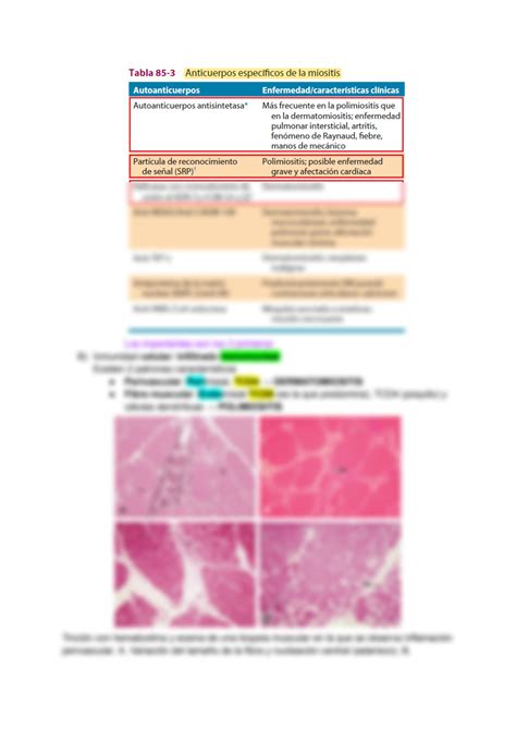 Solution Polimiositis Y Dermatomiositis Studypool