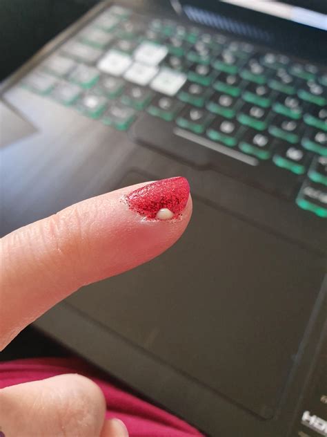Finger Was A Bit Tender Didnt Expect This To Squirt Out Or I Would