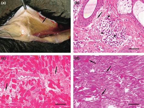 Subcutaneous Oedema In Neck Arrow B Skin Face Separation Of Download Scientific Diagram