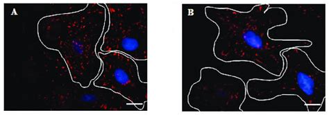 The Influence Of No Us Treatment On Integrin Clustering A B The Download Scientific Diagram