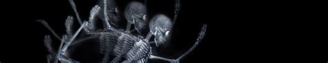 Hackers Can Use DICOM Bug To Hide Malware In Medical Images