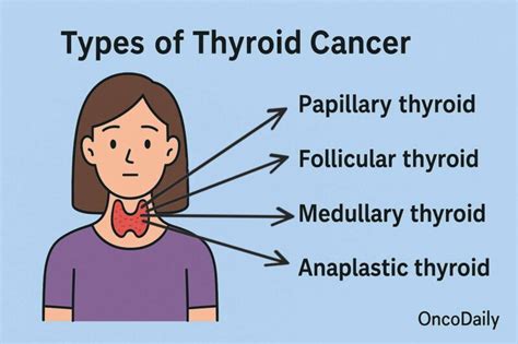 Thyroid Cancer Symptoms Causes Stages Diagnosis And Treatment