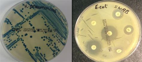 Take A Mastitis Sample Before You Treat With Tubes Tirlán Farmlife