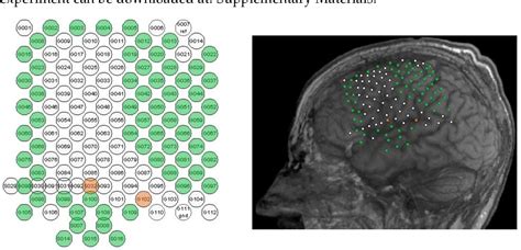 Figure 1 From Application Of Soft Clustering To Assess Consciousness In