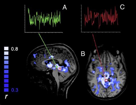 Noise Correction Method A Mean Rest Scan Time Course Of Voxels In Download Scientific