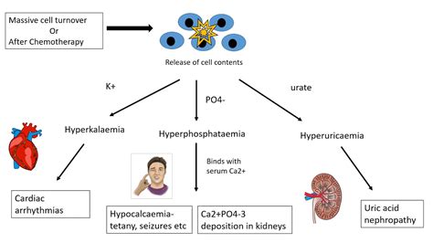 Tumor Lysis Syndrome Tumour Lysis Syndrome — The Intern At Work