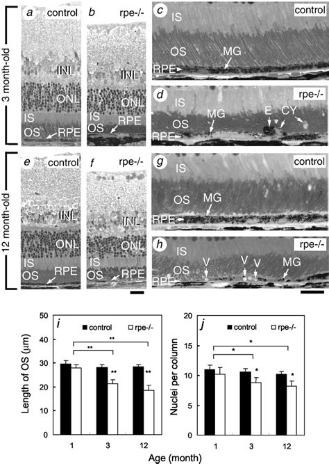 Histological Abnormalities In Rpe And Neural Retina Of Adult Rxr Rpe