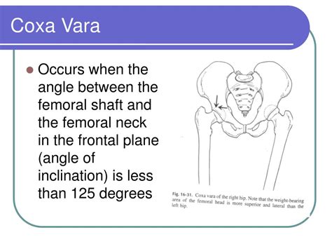 Ppt Evaluation Of The Hip And Thigh Powerpoint Presentation Free