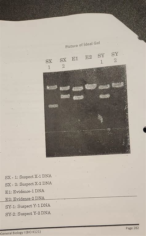 Solved SX 1 Suspect X 1 DNA SX 2 Suspect X 2 DNA EI Chegg Com