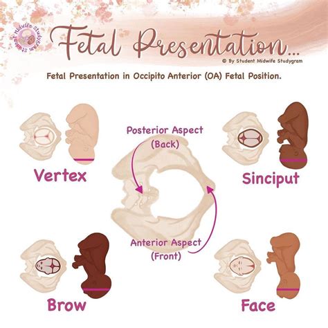 ⬆️⬇️fetal Presentation In The Student Midwife Studygram