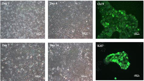Figure 2 From Transplantation Of Chemically Induced Liver Progenitor