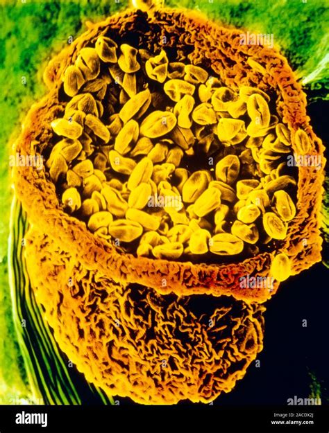 False Colour Scanning Electron Micrograph Sem Of A Mature Pollen Bearing Anther Of The Wild