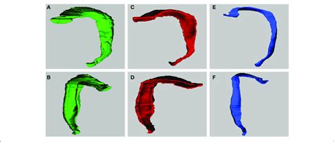 3 Dimensional Models Of Dentate Gyrus Layers Models Are Constructed Download Scientific