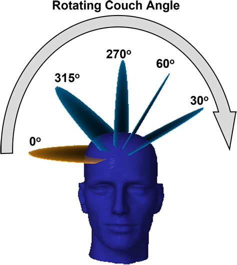 Dosimetric Effects Of Dynamic Jaw Tracking And Collimator Angle Optimization In Non Coplanar