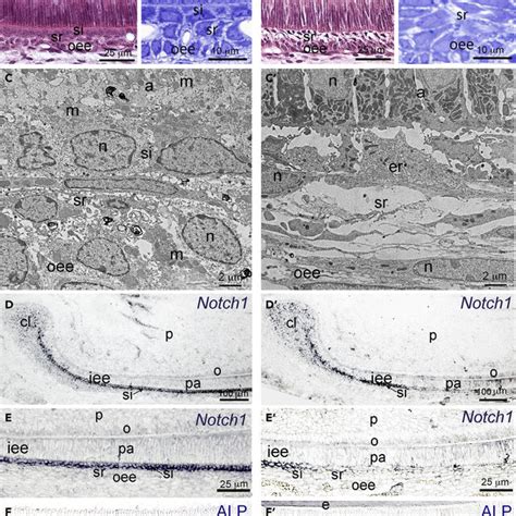 Adam10 Deletion Induces Loss Of The Stratum Intermedium Downregulation Download Scientific