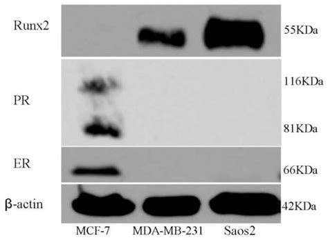 Positive Association Between Nuclear Runx And Oestrogen Progesterone Receptor Gene Expression