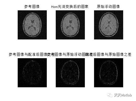 【图像配准】基于光流场算法horn Schunck和brox及lucas Kanade实现医学图像配准matlab代码 基于光流的图像配准 Csdn博客