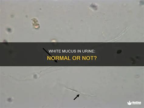 White Mucus In Urine Normal Or Not Medshun