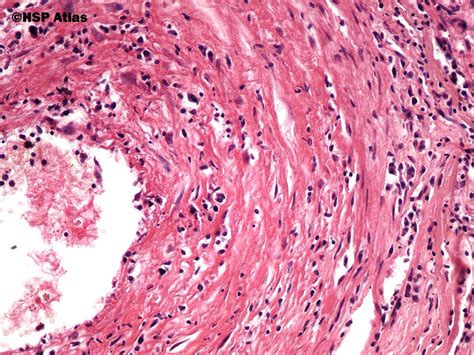 Hsp Atlas Histopathology Atlas Heart And Vessels
