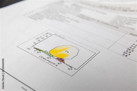 Patient Flow Cytometry Test Report Flow Cytometry Stock Photo Adobe Stock