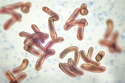 Cholera Signs Symptoms And Treatment Au