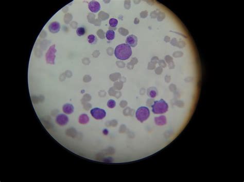 Proeritroblasto Eritroblasto Basofilico Eritroblasto Ort… Flickr