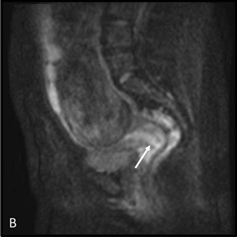 Motion Artifacts Are Prevalent In Mr Imaging Of Pregnant Patients Due Download Scientific
